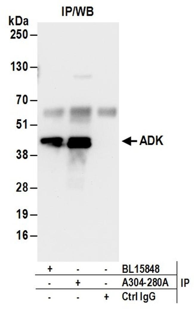 ADK Rabbit anti-Human, Mouse, Polyclonal, Bethyl Laboratories 100 µL ...