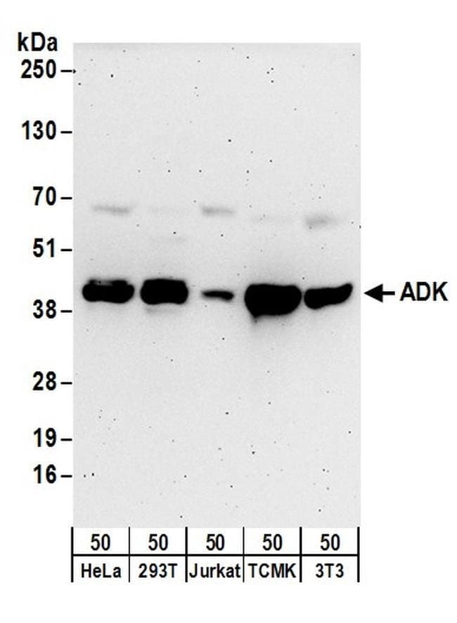 ADK Rabbit anti-Human, Mouse, Polyclonal, Bethyl Laboratories 100 µL ...