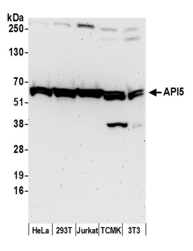 API5 Polyclonal Antibody, Bethyl Laboratories:Antibodies:Primary ...