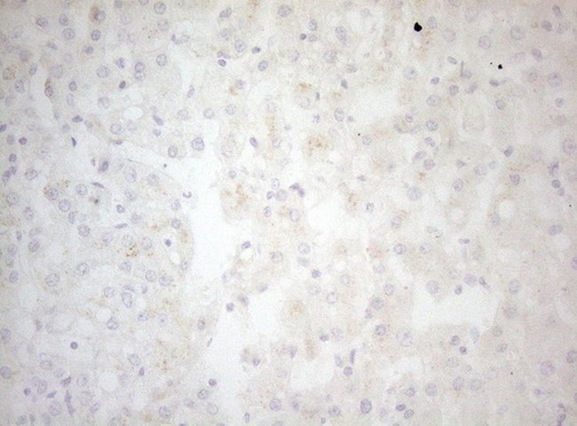 BCL2L14 Mouse anti-Human, Clone: OTI6D1, lyophilized, TrueMAB 100 μg ...