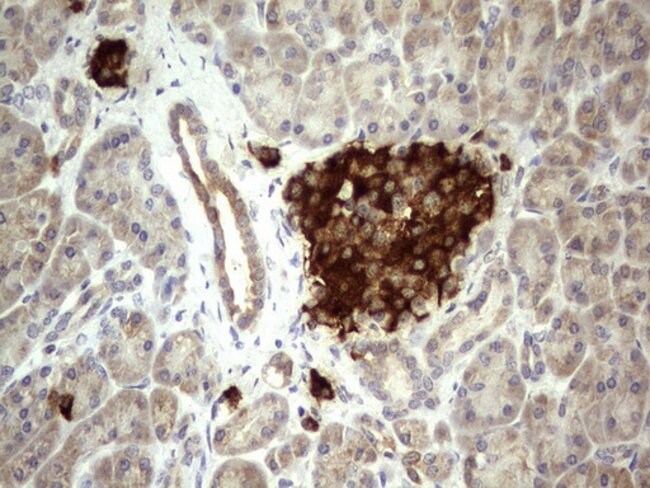 BFSP1 Monoclonal Antibody (OTI1F4), TrueMAB , OriGene 100 μL ...