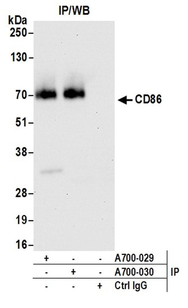 CD86 Recombinant Rabbit Monoclonal Antibody (BLR030F), Bethyl ...