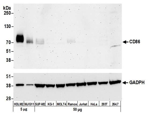 CD86 Recombinant Rabbit Monoclonal Antibody (BLR030F), Bethyl ...