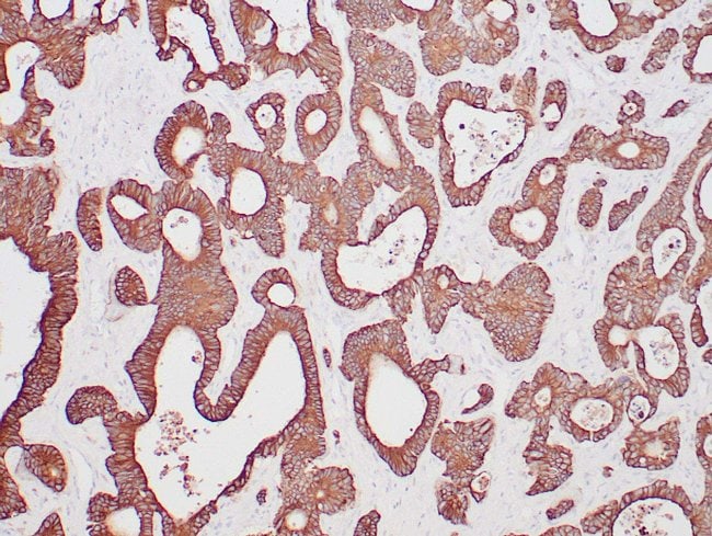 Cytokeratin 20 Monoclonal Antibody (ZM42), MonoMab , Zeta 1mL ...