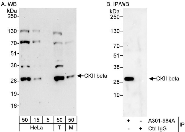 CKII beta Rabbit anti-Human, Mouse, Polyclonal, Bethyl Laboratories 100 ...