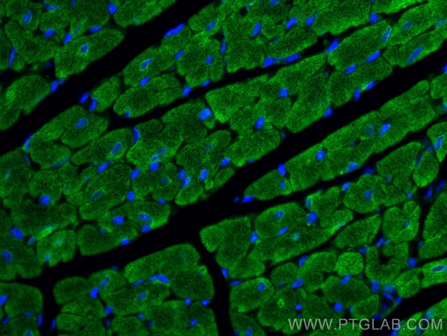 Myosin Light Chain 2/MLC-2V Polyclonal Antibody, CoraLite488 ...