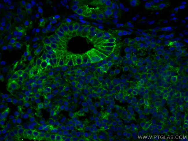 Beta-2-Microglobulin Monoclonal Antibody (1C3B7), CoraLite488 ...