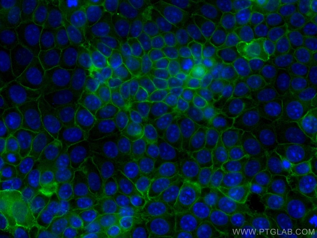 GNAS Monoclonal Antibody (1A9C10), CoraLite488, Proteintech 100 μL ...