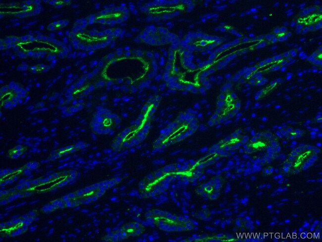PSMA/GCPII Monoclonal Antibody (3G4E12), CoraLite488, Proteintech 100 ...
