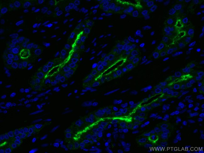 PSMA/GCPII Monoclonal Antibody (3G4E12), CoraLite488, Proteintech 100 ...