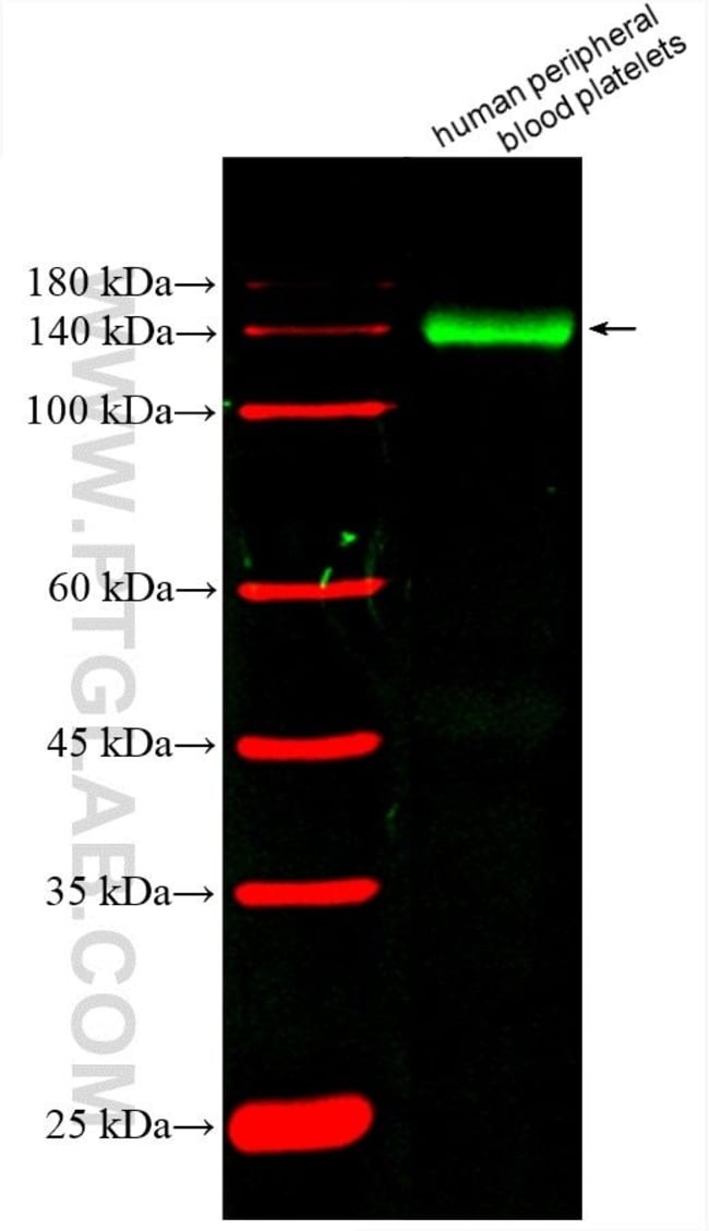 GP1BA Monoclonal Antibody (3G1F5), CoraLite488, Proteintech 100 μL ...