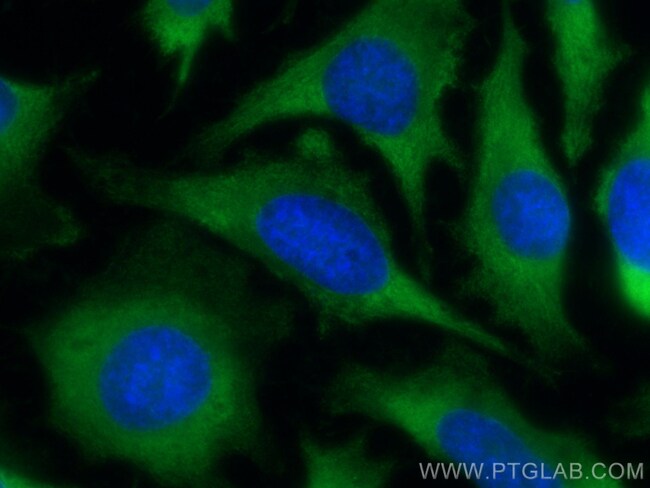 PAIP1 Monoclonal Antibody (2H9D4), CoraLite488, Proteintech 100 μL ...