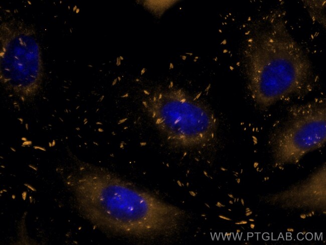 FAK Monoclonal Antibody (2C5B9), CoraLite555, Proteintech 100 μL ...