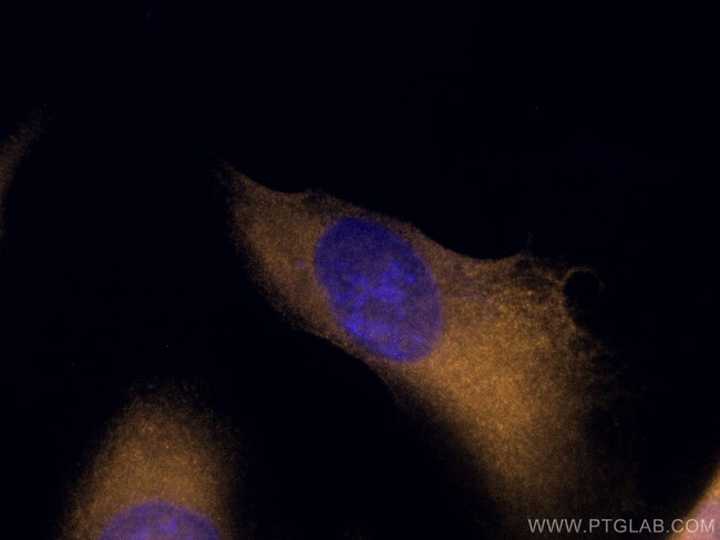 G6PD Monoclonal Antibody (2A7B12), CoraLite555, Proteintech 100 μL ...