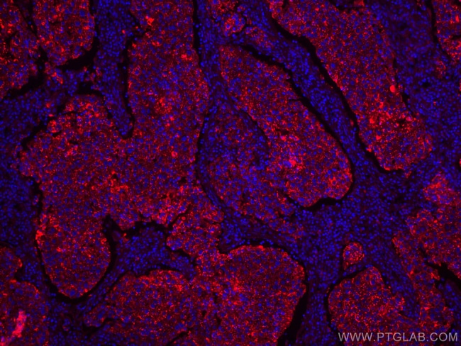 LGALS3BP Monoclonal Antibody (2D8E11), CoraLite594, Proteintech 100 μL ...