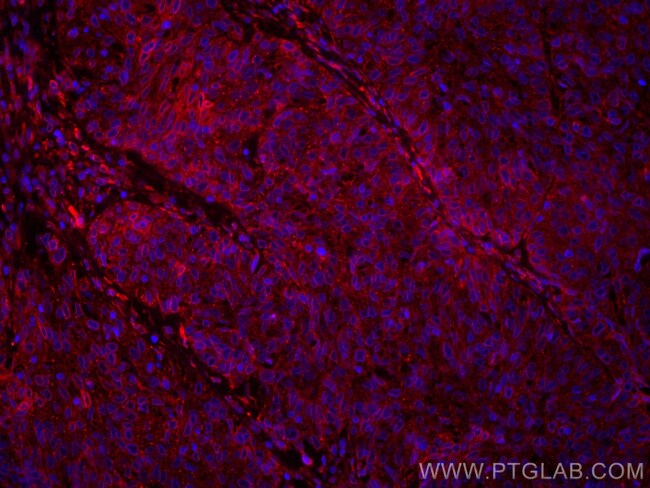 PGRMC2 Monoclonal Antibody (5F10D7), CoraLite594, Proteintech 100 μL ...