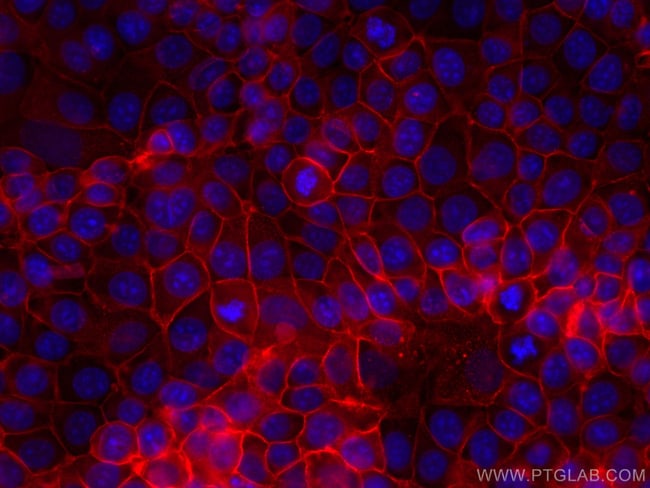 GNAS Monoclonal Antibody (1A9C10), CoraLite594, Proteintech 100 μL ...