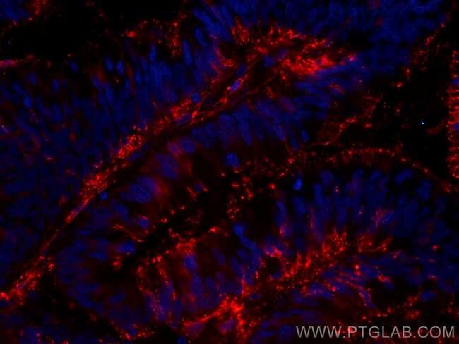 Galectin-4 Monoclonal Antibody (3C2G3), CoraLite594, Proteintech 100 μL ...