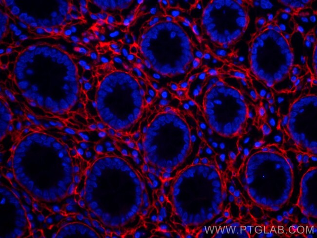 Collagen Type III Recombinant Rabbit Monoclonal Antibody (2O1 ...