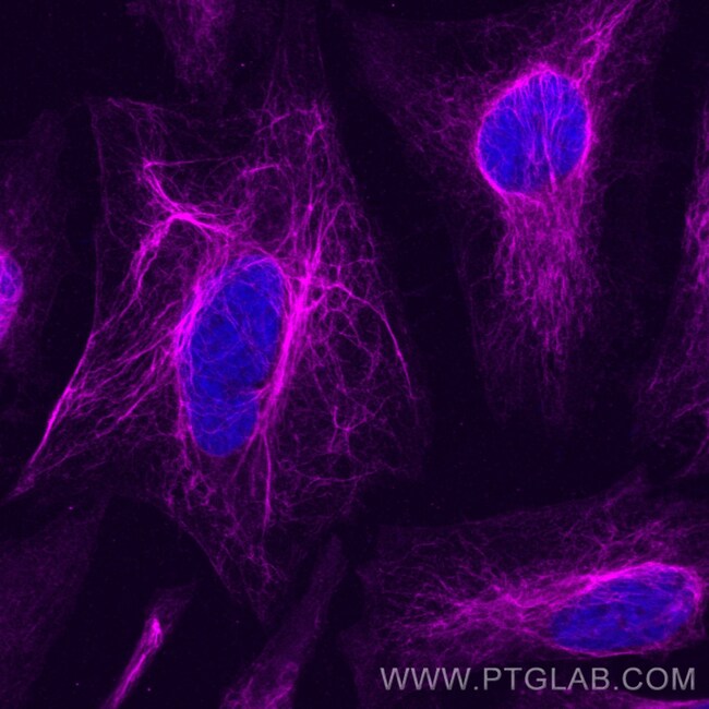 Vimentin Recombinant Rabbit Monoclonal Antibody (6K21), CoraLite647 ...