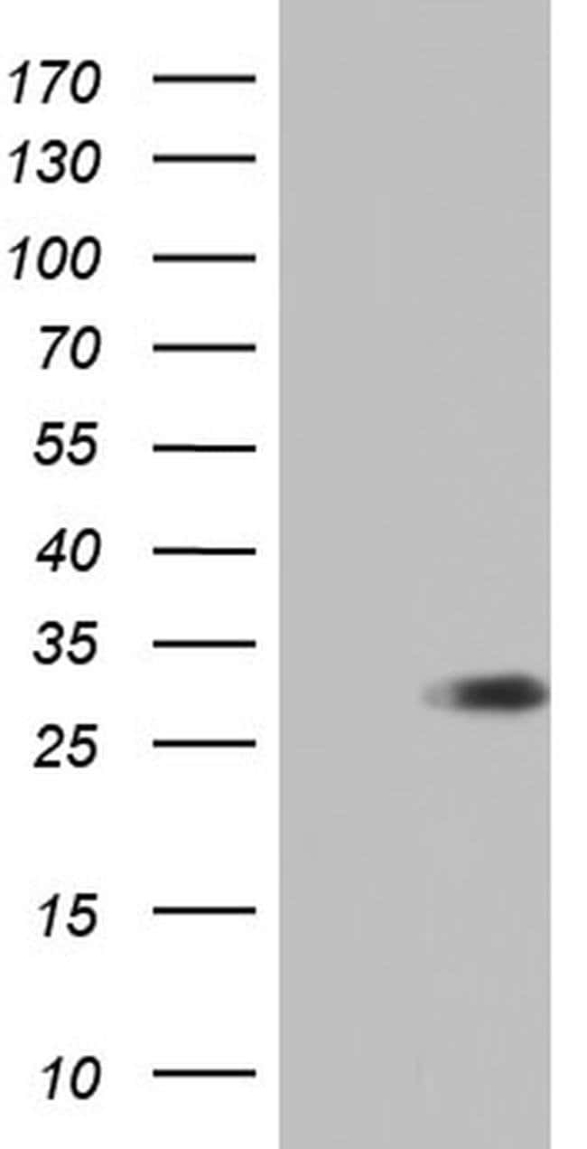 ENKUR Monoclonal Antibody (OTI1C8), TrueMAB , OriGene 100 μL ...