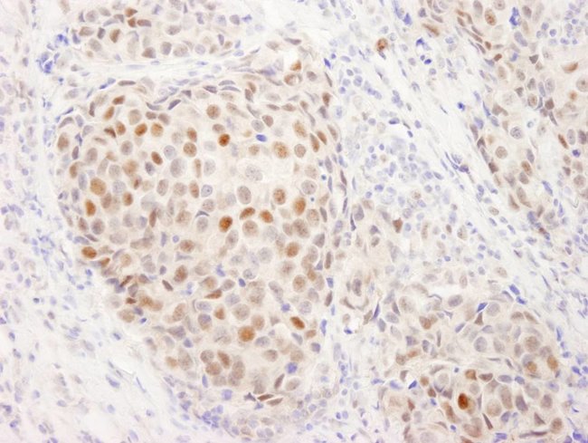 Estrogen Receptor Alpha IHC, Polyclonal, Bethyl Laboratories 10 µL ...