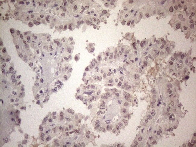 ERCC8 Mouse anti-Human, Clone: OTI2G1, lyophilized, TrueMAB™ 100 μg ...