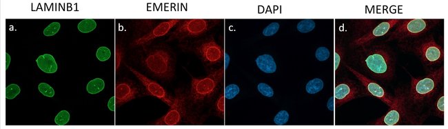 Invitrogen Emerin Monoclonal Antibody (CL0203) 100 μL | Buy Online ...