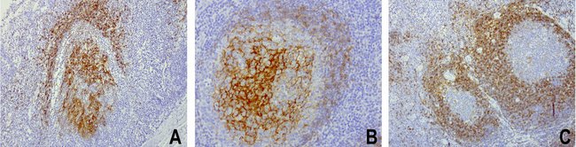 FCER2 Mouse anti-Human, Clone: UMAB101, liquid, UltraMAB 100 μL ...