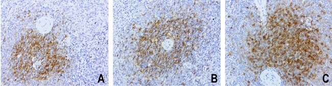 FCER2 Mouse anti-Human, Clone: UMAB101, liquid, UltraMAB 100 μL ...