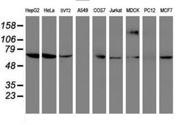 FOLH1 Mouse anti-Canine, Human, Mouse, Rat, Clone: OTI2E1, TrueMAB ...