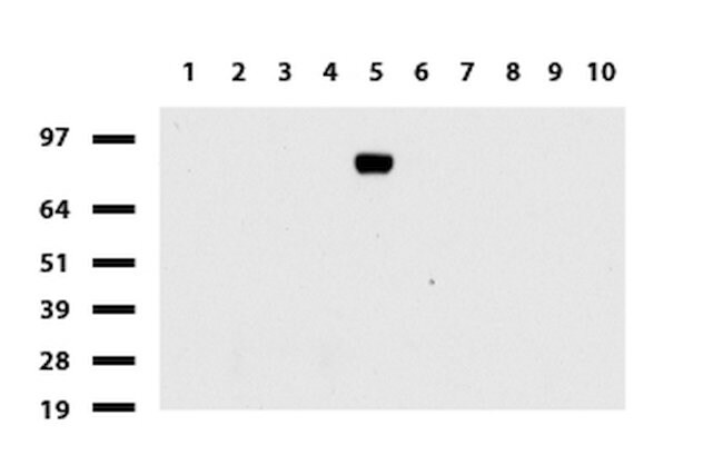 FOLH1 Mouse anti-Human, Clone: UMAB27, liquid, UltraMAB™ 100 μL ...