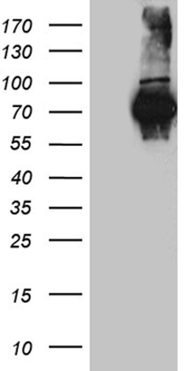 FUBP3 Monoclonal Antibody (OTI5H6), TrueMAB , OriGene 100 μL ...