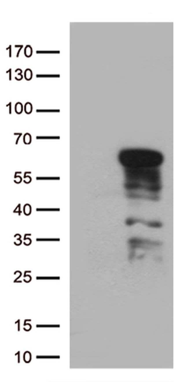 GATA3 Mouse anti-Human, Clone: OTI8H4, liquid, TrueMAB 100 μL ...