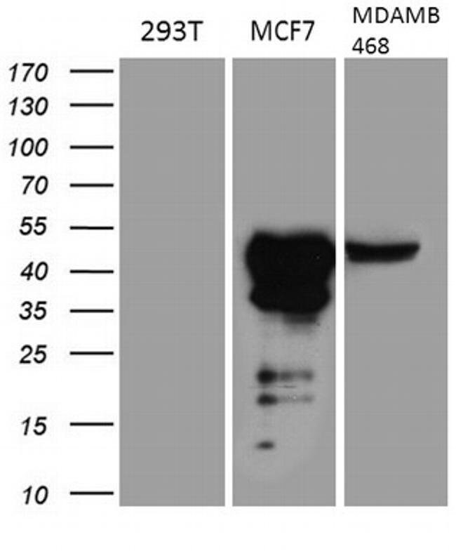 GATA3 Mouse anti-Human, Clone: OTI8H4, liquid, TrueMAB 100 μL ...