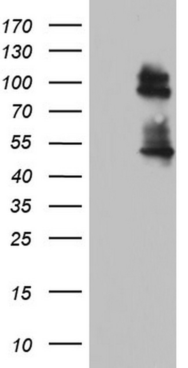GLI1 Mouse anti-Human, Clone: OTI4C8, lyophilized, TrueMAB™ 100 μg ...