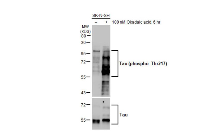 Phospo-Tau (Thr217) Monoclonal Antibody (HL1276), Invitrogen 100 μL ...
