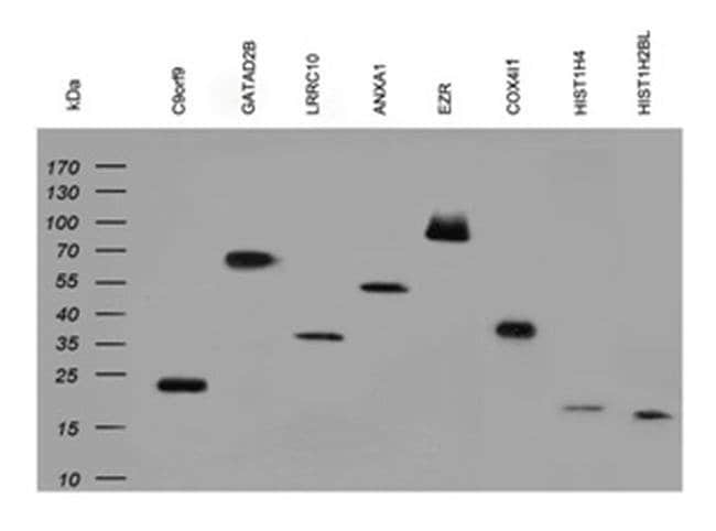 His Tag Mouse anti-Tag, Clone: OTI2B5, lyophilized, TrueMAB 400 μg ...