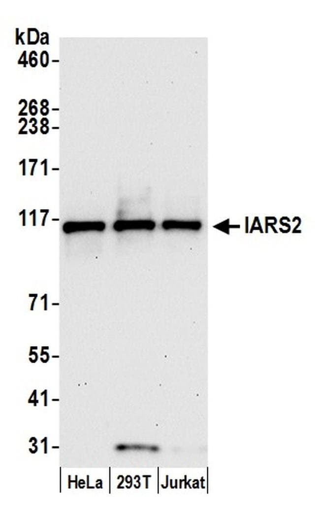 IARS2, Polyclonal, Bethyl Laboratories:Antibodies:Primary Antibodies ...