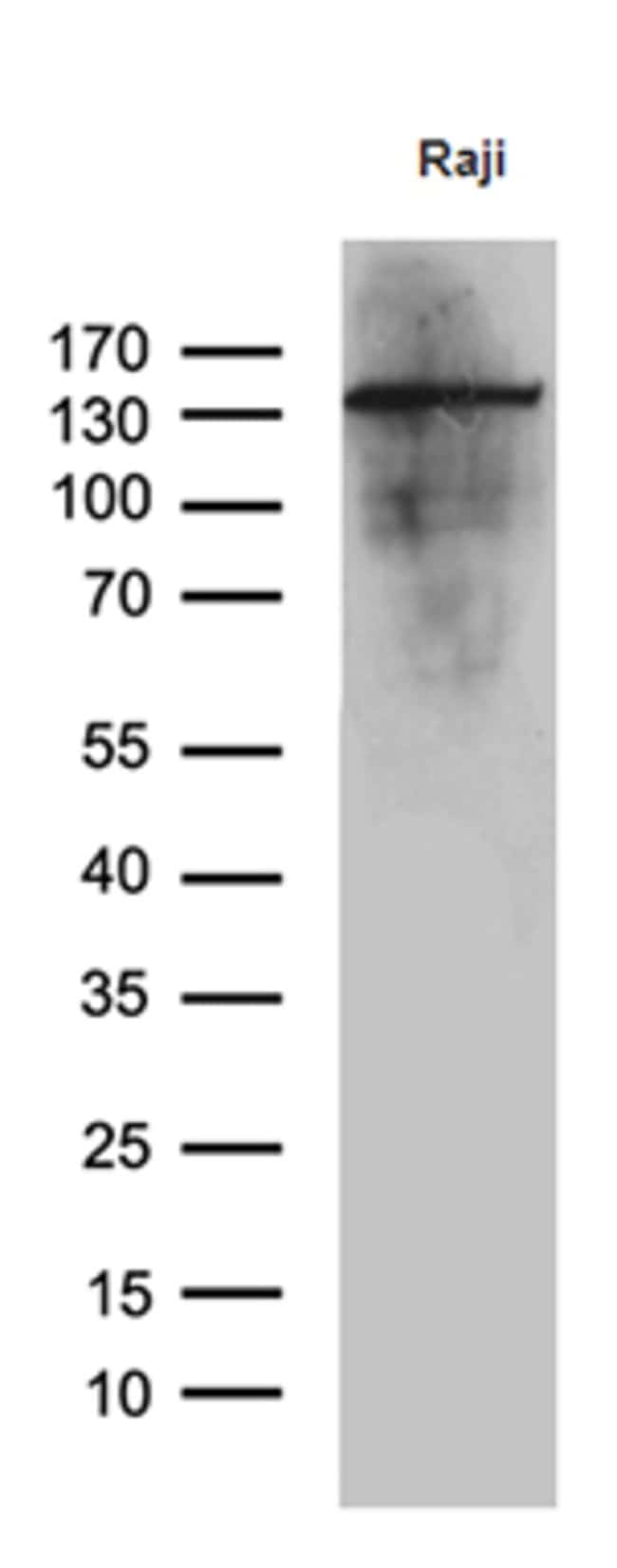 IFIH1 Mouse anti-Human, Clone: OTI1C7, lyophilized, TrueMAB 100 μg ...