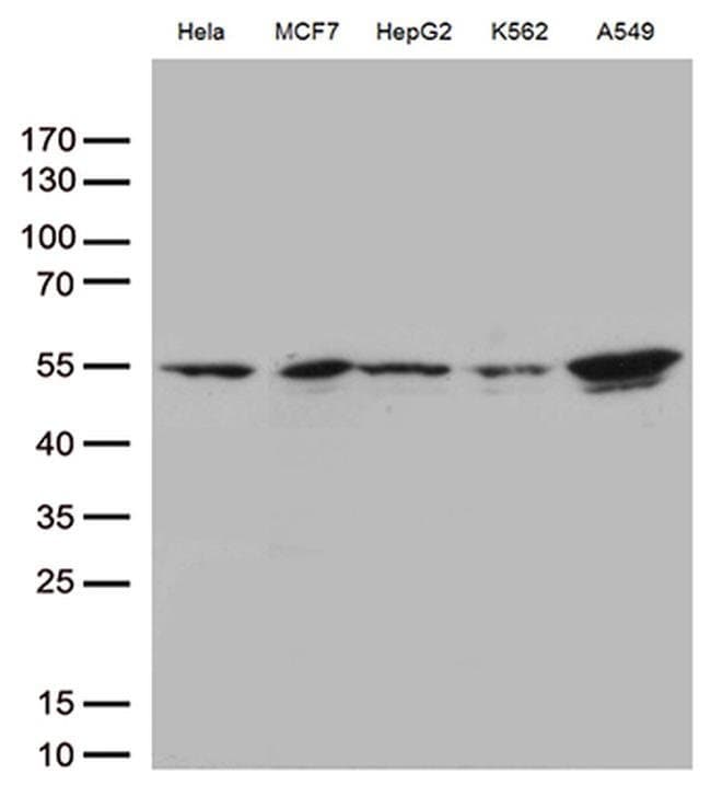 IKBKG Mouse anti-Human, Clone: OTI6B7, TrueMAB , Origene 30 μL ...