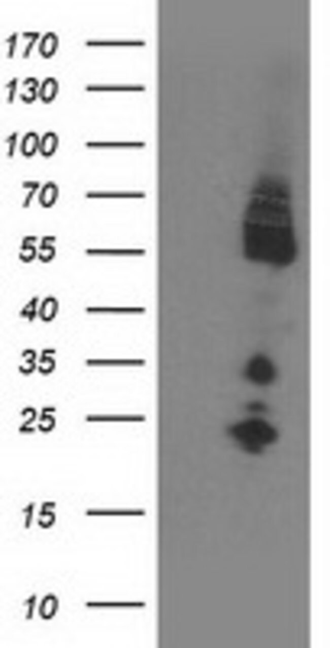 IRF6 Mouse anti-Human, Clone: OTI1B9, lyophilized, TrueMAB 100 μg ...