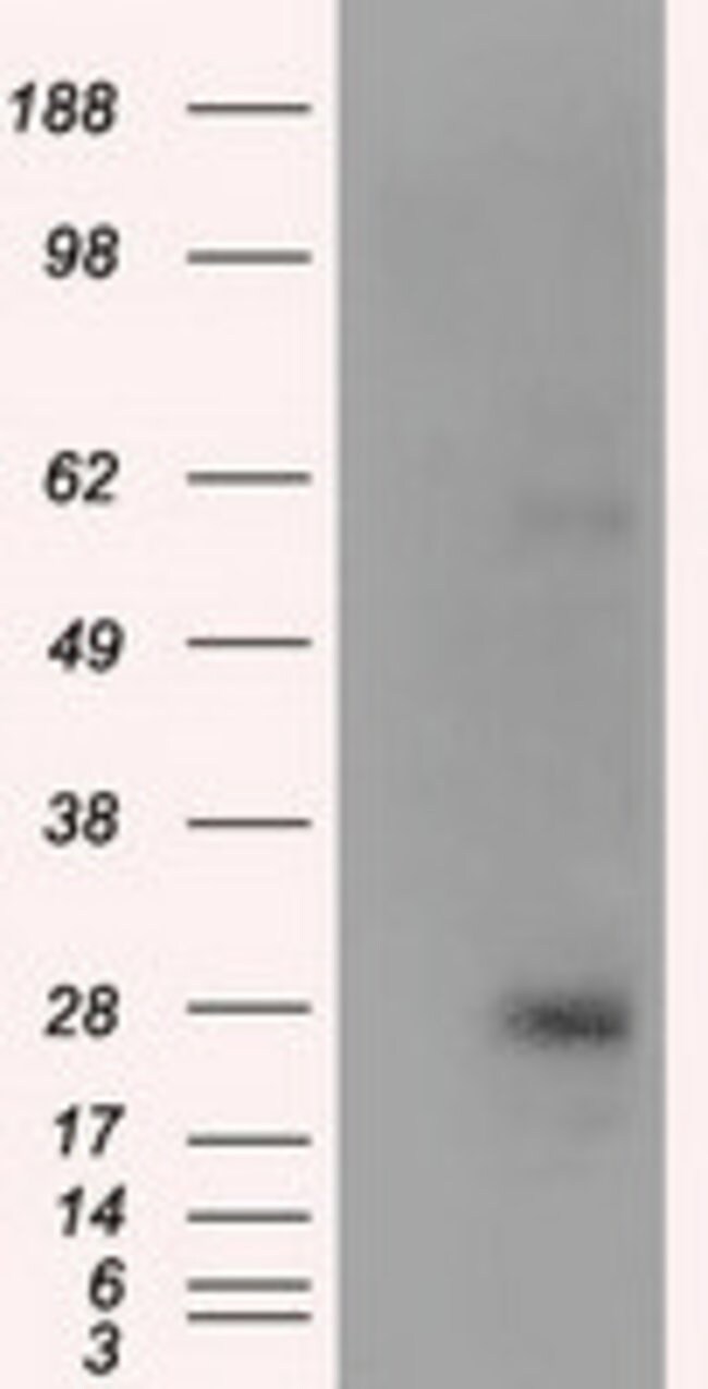 KCTD5 Mouse anti-Human, Clone: OTI3C8, lyophilized, TrueMAB™ 100 μg ...
