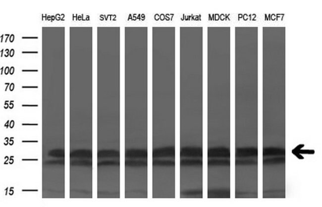 KCTD5 Mouse anti-Human, Clone: OTI3C8, lyophilized, TrueMAB™ 100 μg ...