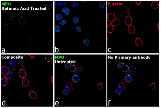 Myeloperoxidase Mouse anti-Human, Clone: 2A11, Invitrogen 100 μg ...