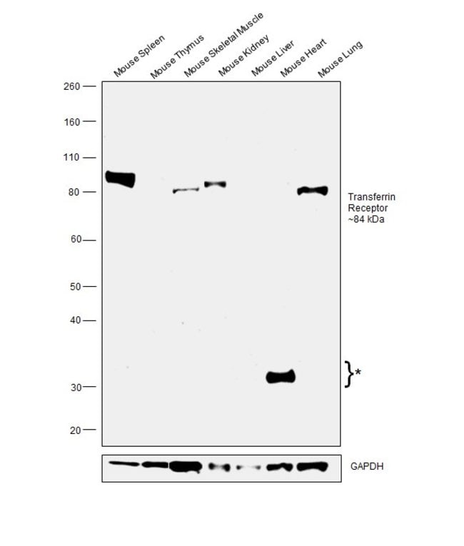 Transferrin Receptor Monoclonal Antibody (YTA74.4), Invitrogen 100 μg ...
