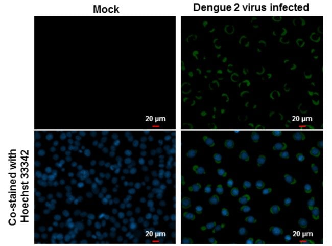 Invitrogen Dengue Virus Type 2 Envelope Monoclonal Antibody (GT214) 100 ...