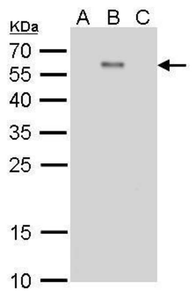 Invitrogen Dengue Virus Type 2 Envelope Monoclonal Antibody (GT214) 100 ...