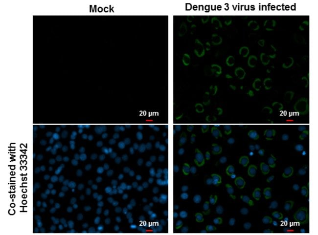 Invitrogen Dengue Virus Type 2 Envelope Monoclonal Antibody (GT643) 100 ...