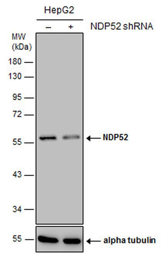 CALCOCO2 Monoclonal Antibody (P422), Invitrogen 100 μL; Unconjugated ...
